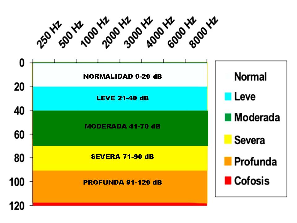Hipoacusia: ¿Qué es? Tipos de pérdida auditiva y sordera